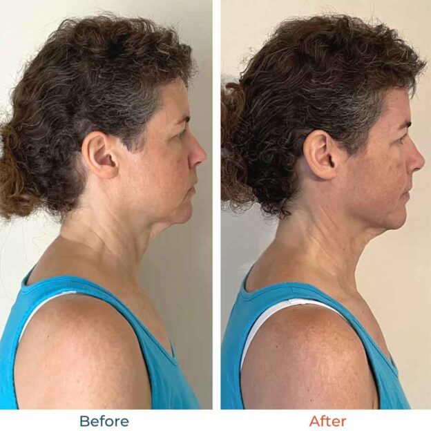 Winner of the 30 Day Upper Body Challenge - Block Therapy