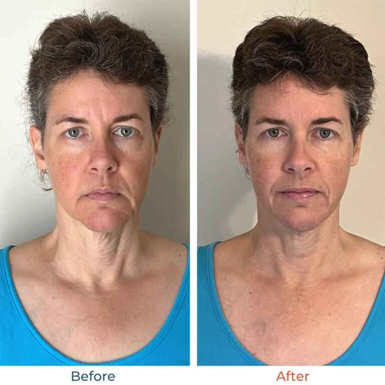 Winner of the 30 Day Upper Body Challenge - Block Therapy