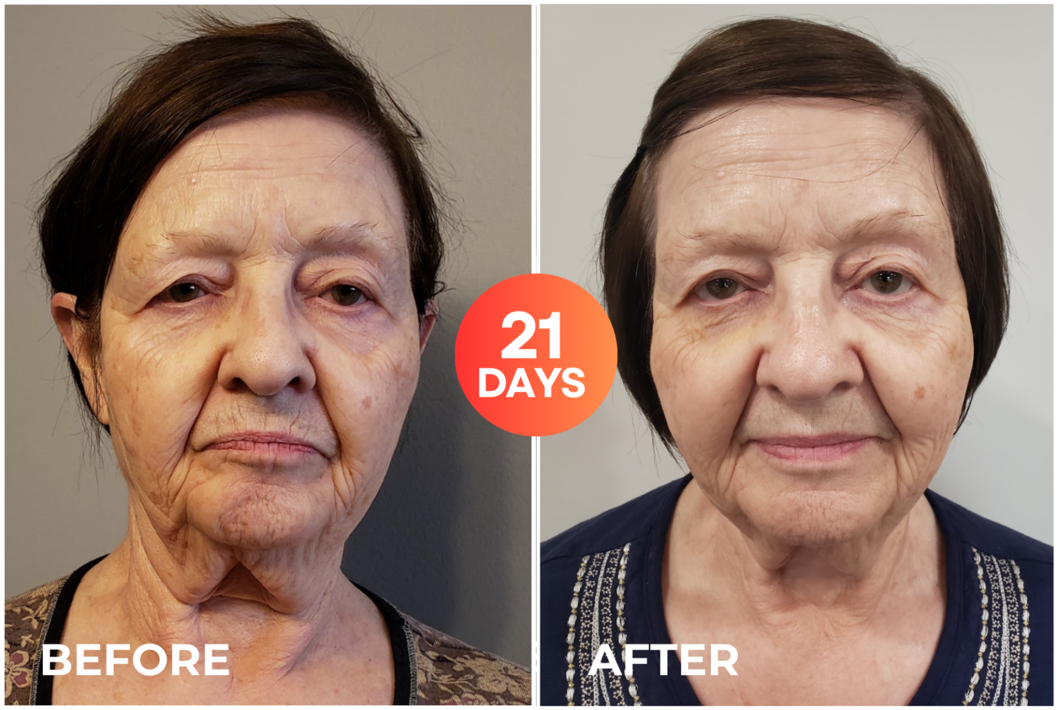 Block Therapy STARTER Kit - Block Therapy