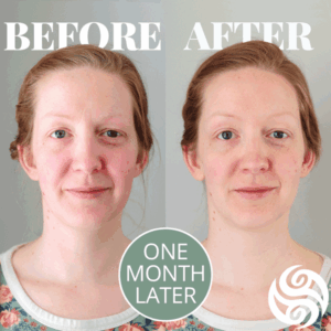 Welcome to Block Therapy - Block Therapy